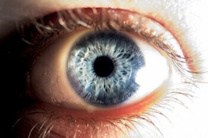 Cornea Albuquerque | Map-Dot-Fingerprint Dystrophy | Eye NM